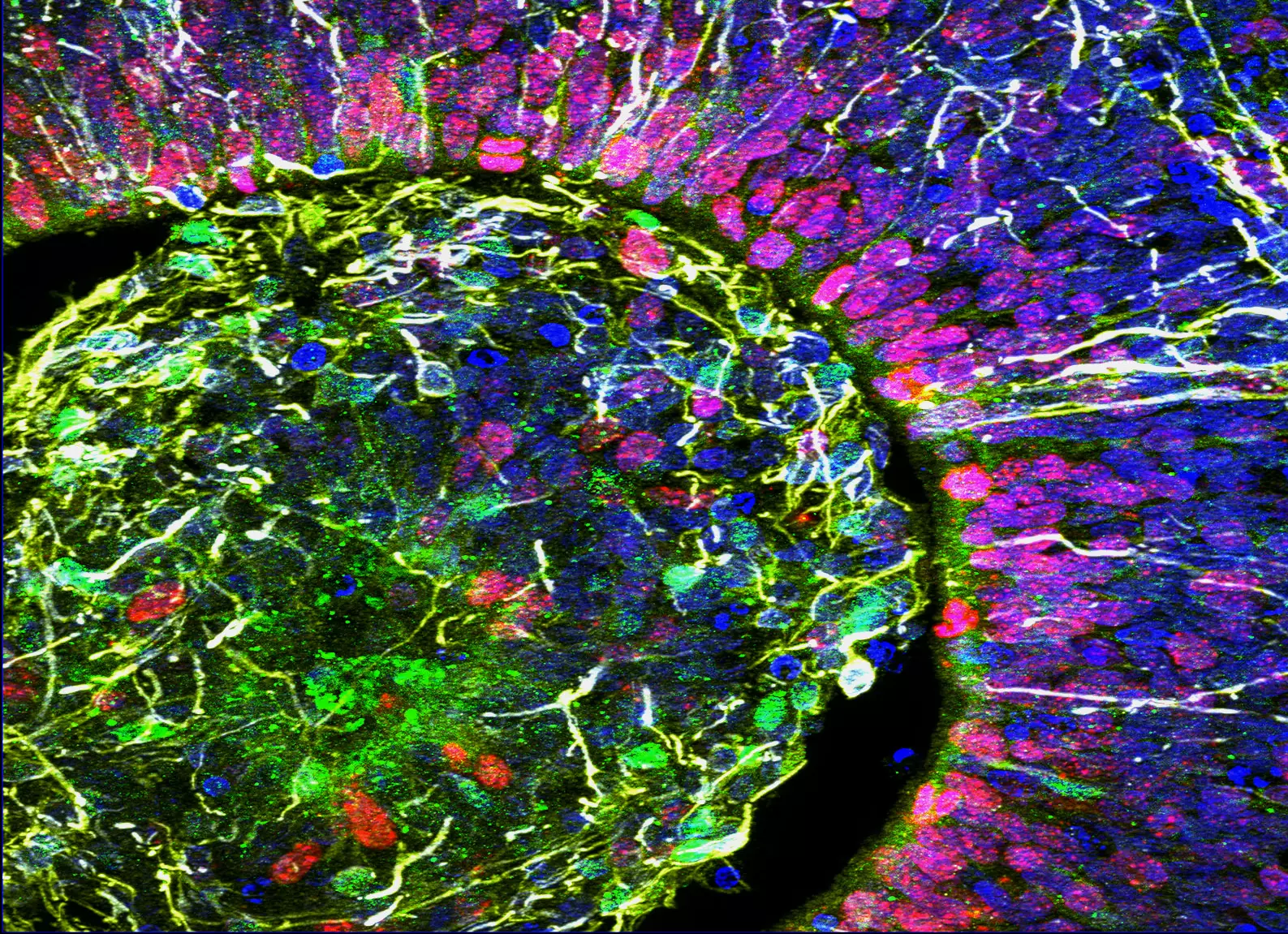 Smegenų organoidai augina neuronines grandines, pradeda gaminti atpažįstamas smegenų bangas