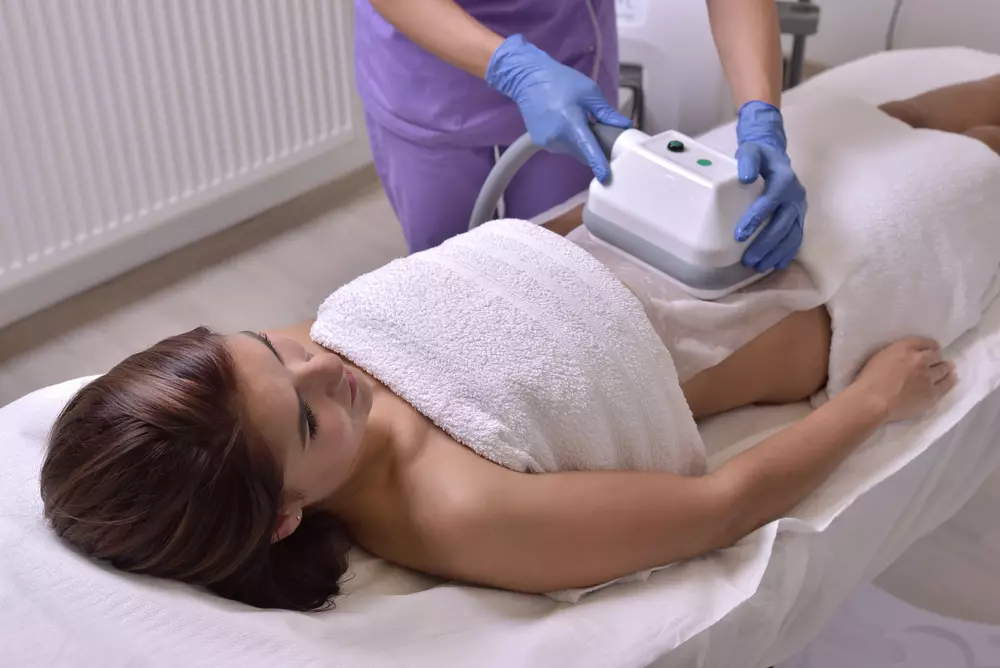 Odmrznite svojo maščobo: Ali je CoolSculpting nova liposukcija?