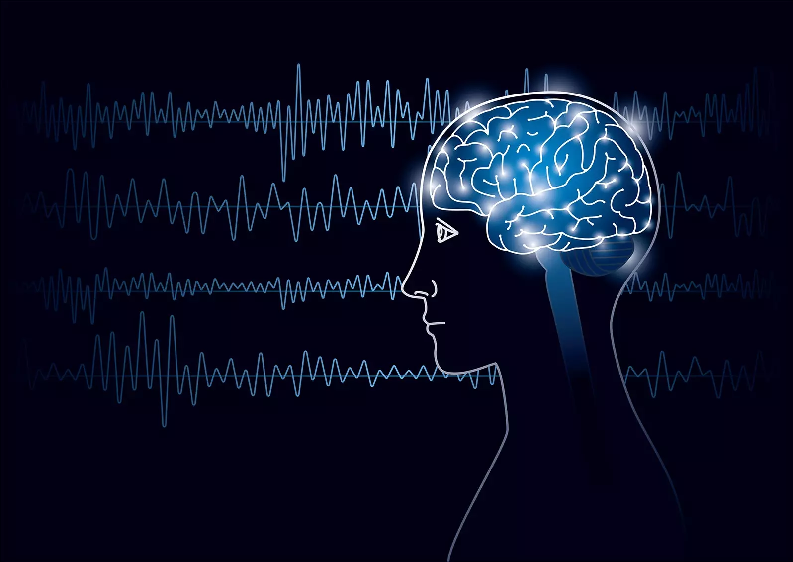 EEG'ler Tepki Vermeyen Hastalarda Bilinç Belirtilerini Saptayabilir