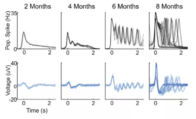 Brainwaves fl-Organoids?